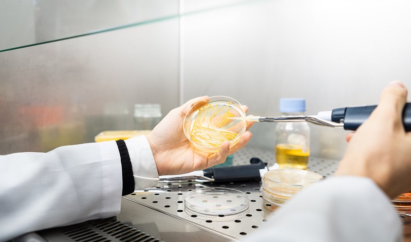 Micro-Val. I batteri mangia-plastica per riciclare i rifiuti organici